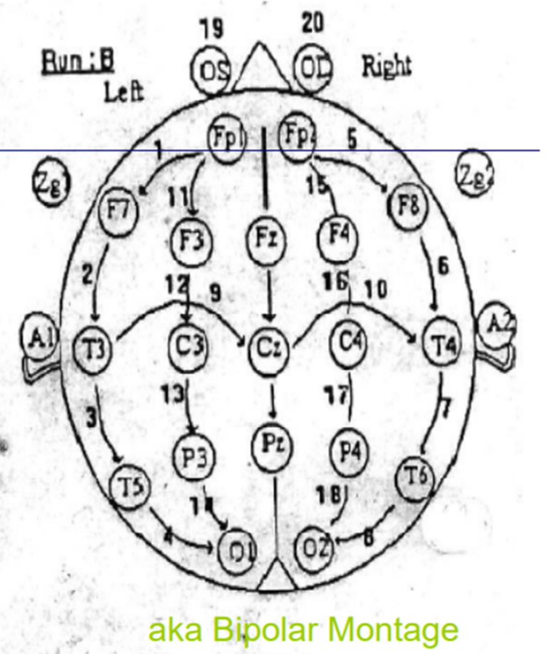 EEG 검사 : 뇌의 전기 활동을 읽다 - BIO PASTA