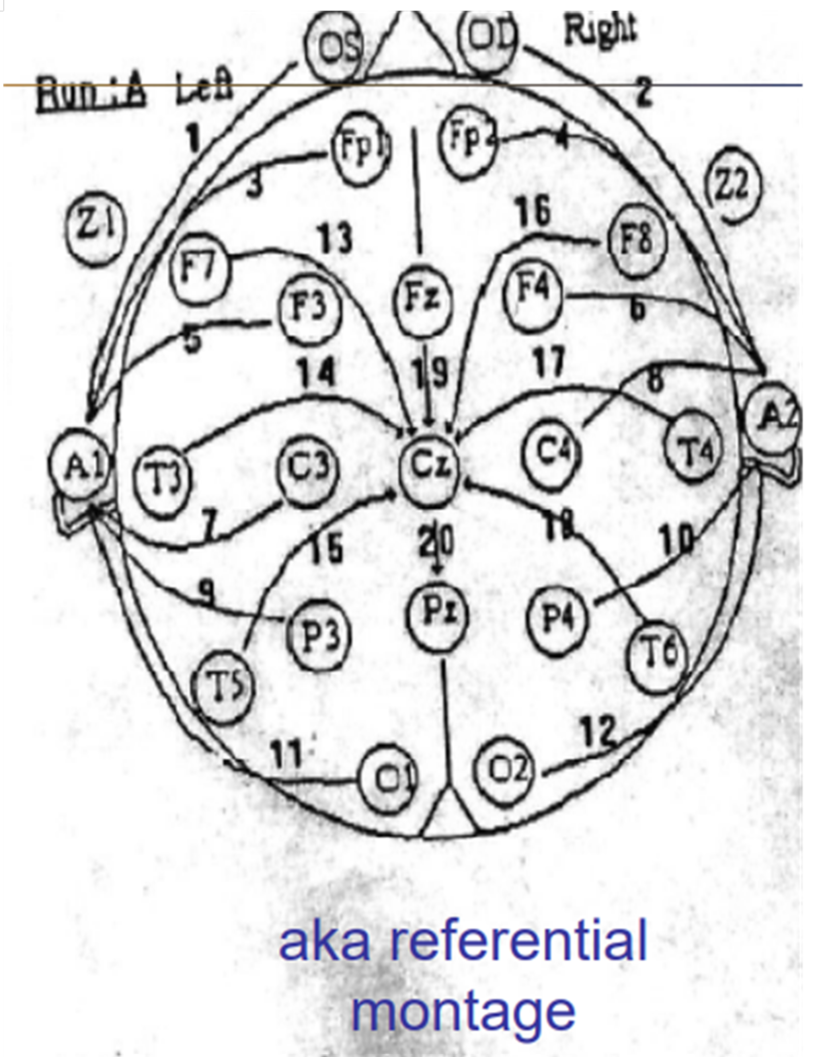 EEG 검사 : 뇌의 전기 활동을 읽다 - BIO PASTA