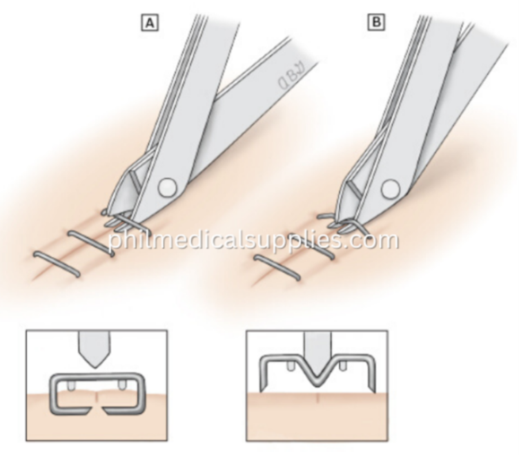 안전하게 의료용 스테이플러 제거하는 방법 - BIO PASTA